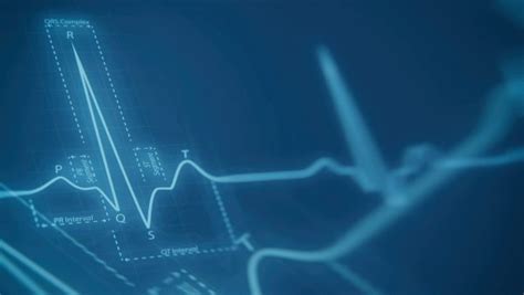 Advancements In Atrial Fibrillation Detection Embracing It Innovations Lucem Health