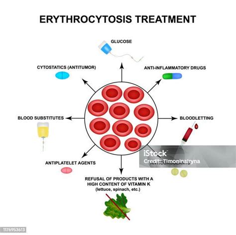 적혈구 증 치료 증가 적혈구 세포 적혈구 헤모글로빈 적혈구의 구조 인포 그래픽 격리된 배경에 대한 벡터 그림입니다 0명에 대한 스톡 벡터 아트 및 기타 이미지 Istock
