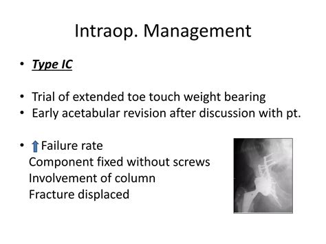 Intraoperative Acetabular Fracture And Pelvic Discontinuity In Thr Pptx Intraoperative Acetabular Fracture And Pelvic Discontinuity In Thr Pptx