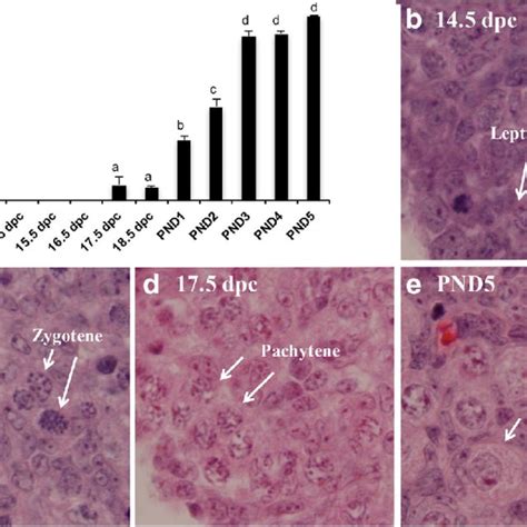 Pdf Arrest At The Diplotene Stage Of Meiotic Prophase I Is Delayed By Progesterone But Is Not