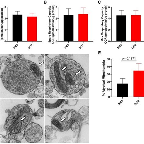 Microglia Modeling Workflow Using Imaris A 20 µm Thick Mouse