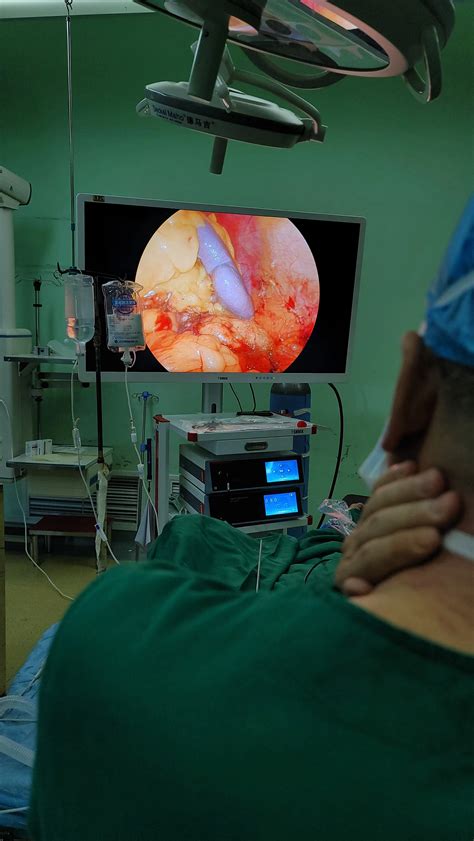 3d 4k Laparoscopy Endoscopic Camera System German Tech