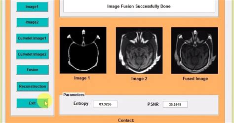 Image Fusion Using Curvelet Transform Matlab Project With Source Code ~ Engineering Projects