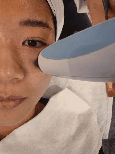 광화문역피부과 튠페이스리프팅 플라즈마 가격 효과 통증 솔직후기 네이버 블로그