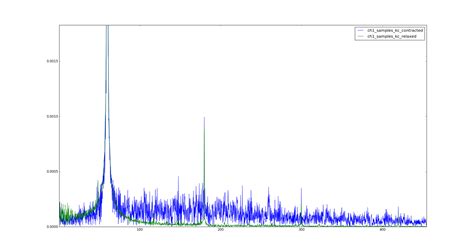 Ads1292 Removing Common Mode Noise 60 Hz Data Converters Forum Data Converters Ti E2e