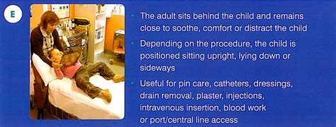 Vcug Procedure