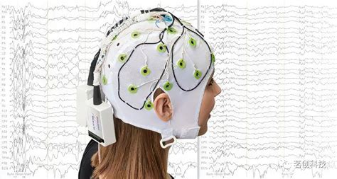 多模态神经成像之eeg Fmri同步fmri和eeg结合使用 Csdn博客