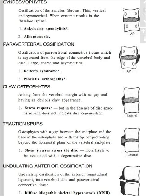 Diffuse Disc Osteophyte Complex Mapasgmaes