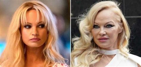 Why Pamela Anderson Never Read Lily James Letter About Pam And Tommy