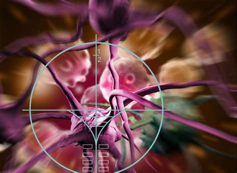 癌症术后得找中医 知乎