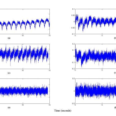 R R Interval For An ECG Exemplary Output Signal Download Scientific Diagram