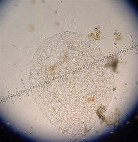 Blepharisma Under Microscope