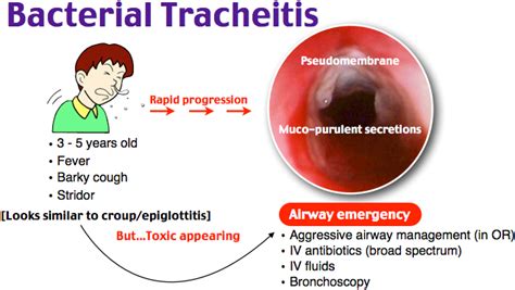 Pediatrics Notes Introduction To Bacterial Tracheitis