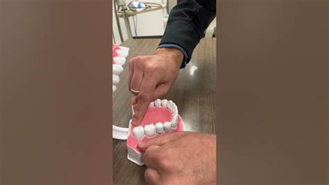 C Shaped Flossing Method Youtube