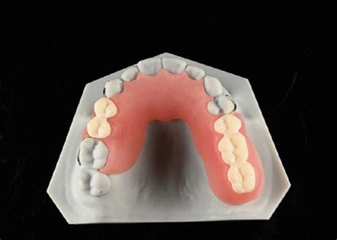 3d Printed Denture Reshaping Oral Health Golden Smile Dental Lab