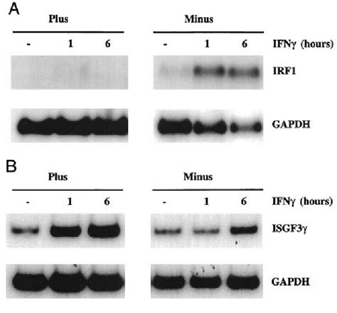 Figure 1 From A Selective Defect Of Ifn γ But Not Of Ifn α Induced Jak Stat Pathway In A Subset