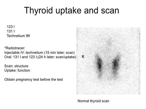 Presentation1 Pptx Radiological Imaging Of The Thyroid Gland Diseases