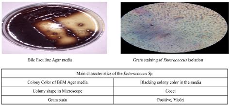 A Selective Media For Enterococcus Sp Identification B Microscopic Download Scientific