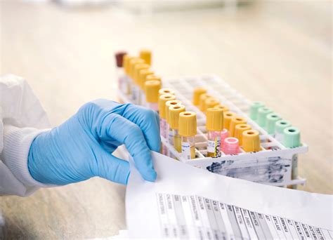 Analizando Los Resultados De Pruebas De Anticuerpos Comprendiendo Su Significado Hematologia Uanl