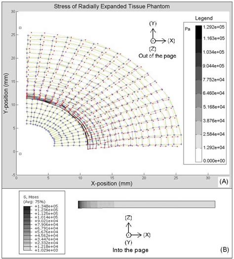 Comparison Between Matlab And Abaqus Output For 20mm Dilated Id
