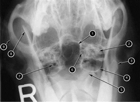 Skull Part 3 Diagram Quizlet