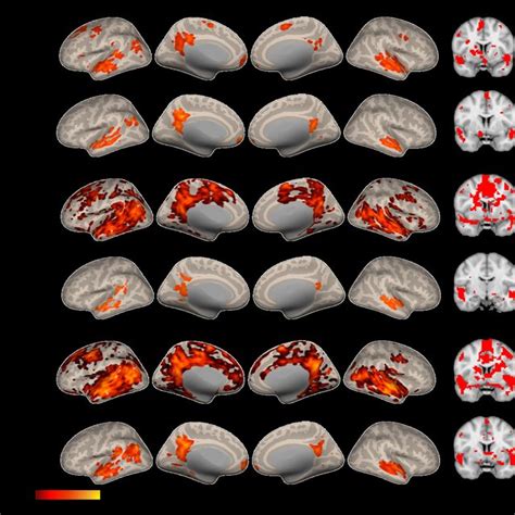 Univariate Whole Brain Analyses A Parametric Effects Of Liking