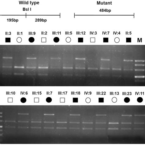 Restriction Fragment Length Polymorphism Analysis Rflp Analysis Shows