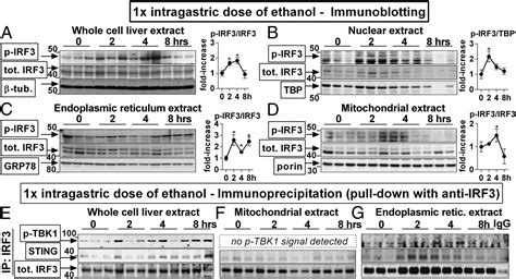 Sting Irf3 Pathway Links Endoplasmic Reticulum Stress With Hepatocyte Apoptosis In Early
