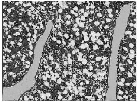 Figure 1 From Image Segmentation Based On Watershed Algorithm