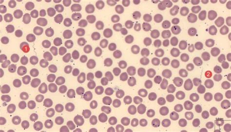 Wavy Wonders Borrelias Appearance Under The Microscope Only Cells