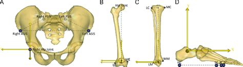 Local Coordinate Frames Of The Bone Segments A Pelvis Asis Anterior Download Scientific