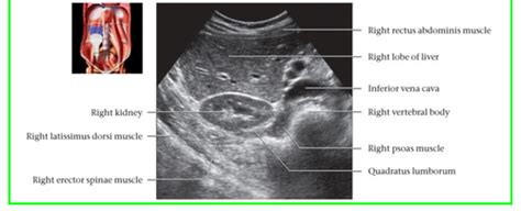 Retroperitoneal Flashcards Quizlet