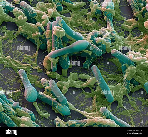 Clostridium Botulinum Bacteria Coloured Scanning Electron Micrograph Sem Of Clostridium