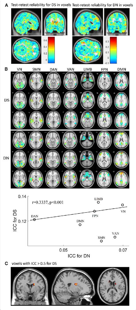 Test Retest Reliability For Ds And Dn A Shows Spatial Distribution Download Scientific