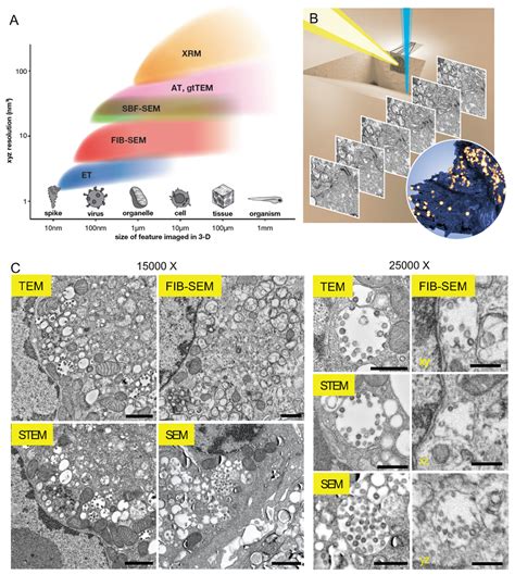 Focused Ion Beam Scanning Electron Microscopy Fib Sem Versus Other