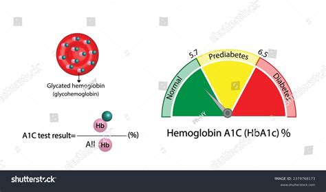 Hemoglobin A1c Hba1c Test Hba1c Levels Stock Vector Royalty Free 2379768173 Shutterstock