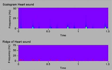 Analysis Of Normal Heart Sounds By Wavelet Transform Method Download Scientific Diagram