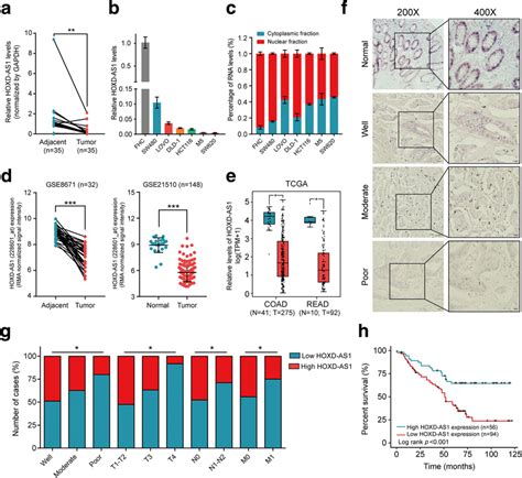 The Down Regulation Of Nuclear Hoxd As1 Predicts Poor Outcome In Crc