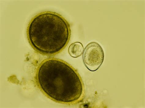Toxocara Cati Egg Under The Microscope Stock Image Image Of Toxocara