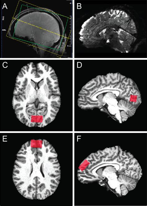 Functional Mri And Mr Spectroscopy Acquisitions A Field Of View Download Scientific Diagram