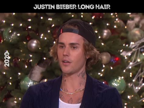 Justin Bieber Hair Transplant Hair Loss And Technical Analysis