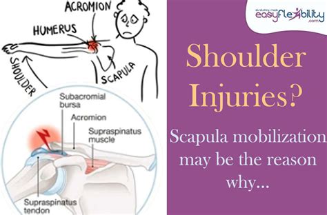 Shoulder Injuries Scapula Mobilization May Be The Reason Why… Easyflexibility