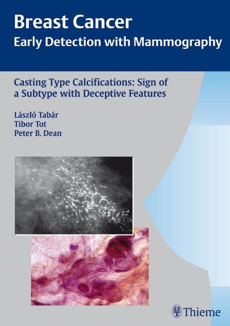 Casting Type Calcifications Sign Of A Subtype With Deceptive Features