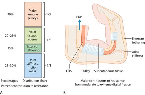 Flexor Tendon Injuries Clinical Tree
