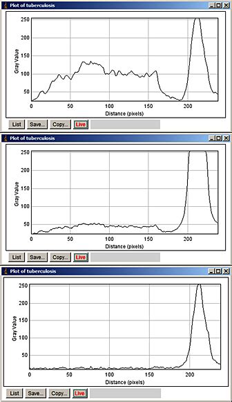 Advanced Image Processing With Imagej
