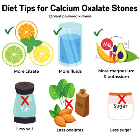 Calcium Oxalate Stones