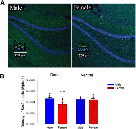 Sex Differences In Maturation And Attrition Of Adult Neurogenesis In The Hippocampus Eneuro