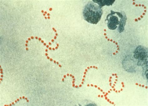 10 Facts About Streptococcus Pyogenes Factsnippet