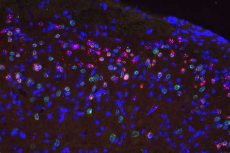 Workflow For Counting Cells With Multiple Fluorophores And Puncta