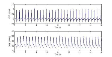 Samples Of Standard Ecg Ii And Abp Waveforms Download Scientific Diagram